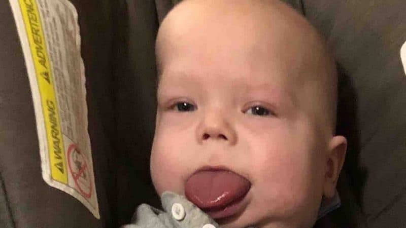 La lingua di questo bimbo cresce all'infinito: l'appello dei genitori