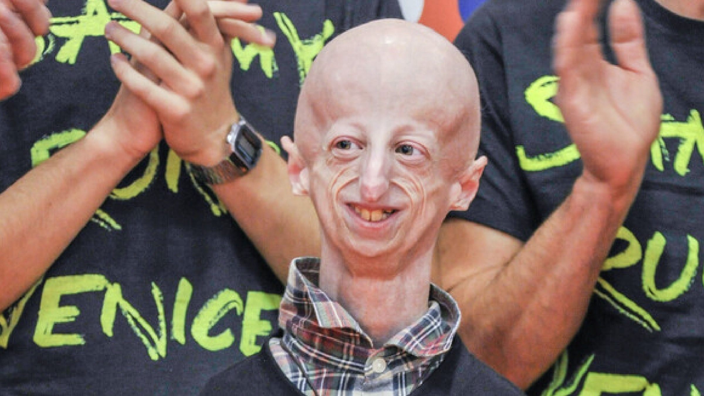 Sammy Basso e la beatificazione, lo ha reso noto il vescovo di Vicenza ...